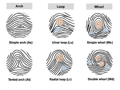 Fingerprint Patterns Linked to Limb Development Genes