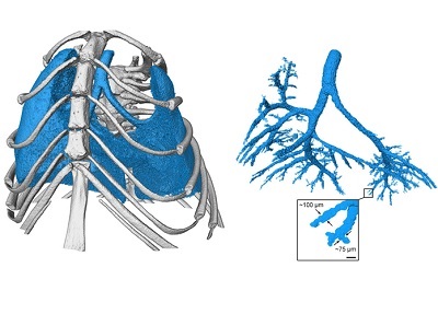 Method Offers Sharper Images of Lung Disease in Living Mice