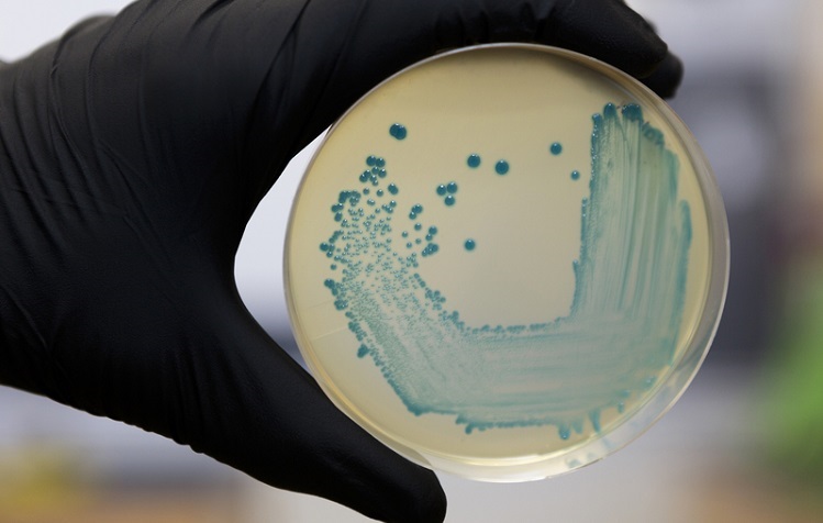 Innocuous Pathogen is Adopting Harmful Characteristics