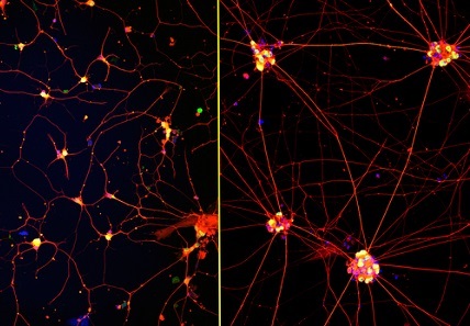 ‘Dancing Molecules’ Help Researchers Create Mature Neurons