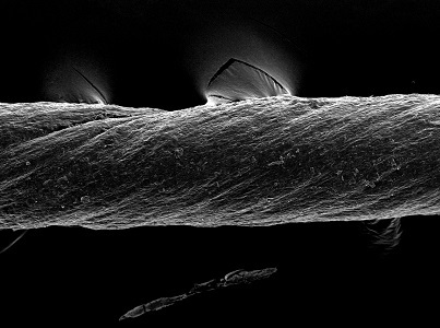 New 'Smart' Sutures Inspired by Ancient Romans Can Deliver Drugs