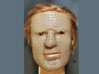 3D-printed Wound Dressing Could Improve Treatment for Burn, Cancer Patients