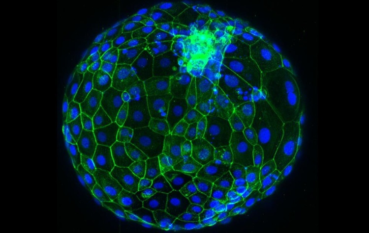 UK Survey Reveals Support for Extending 14-day Embryo Research Rule