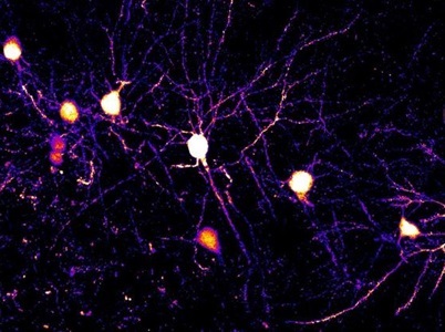 Groundbreaking Study Uncovers how our Brain Learns